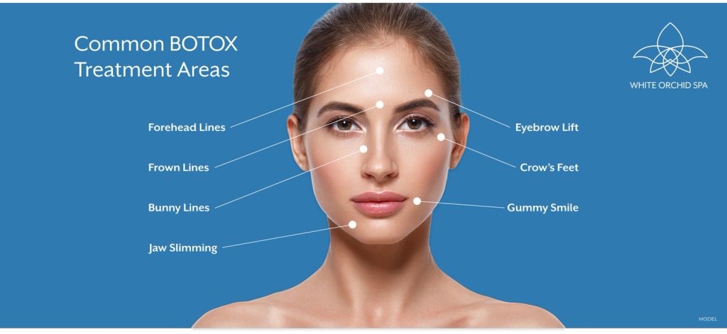 BOTOX® Cosmetic Vero Beach & Melbourne, FL | White Orchid Spa